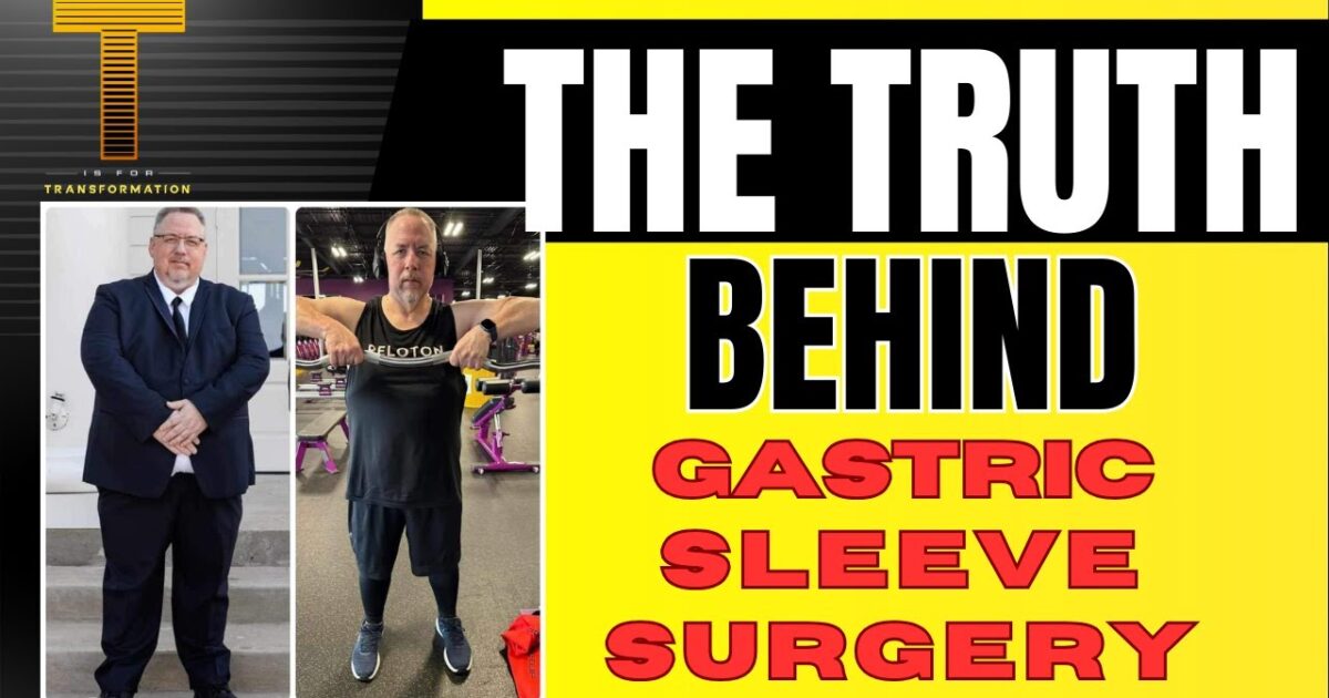 The Truth Behind Gastric Sleeve Surgery - Shaun T Fitness